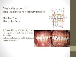 Development of occlusion | PPTX
