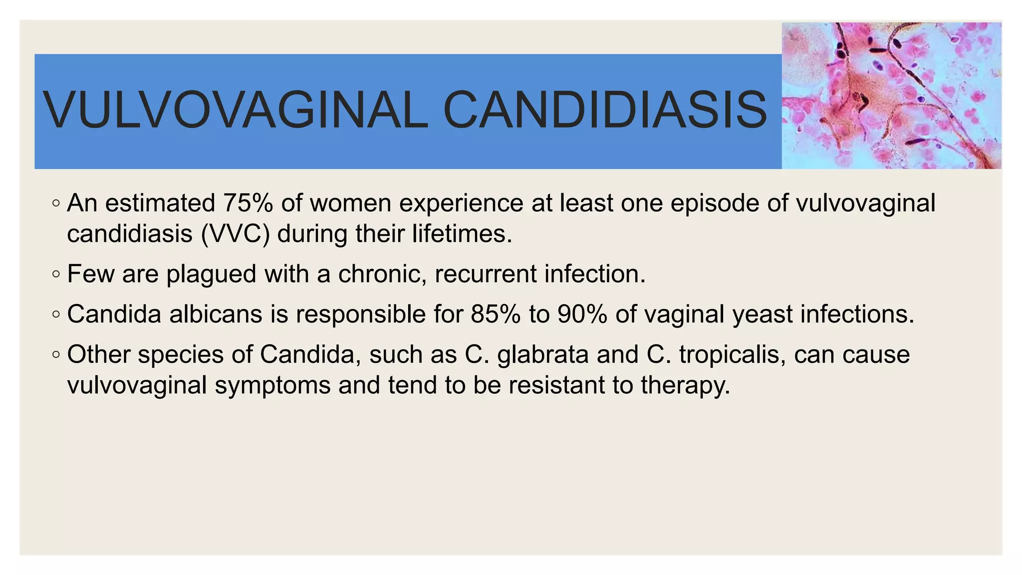 most common causes of infectious vaginitis.pptx