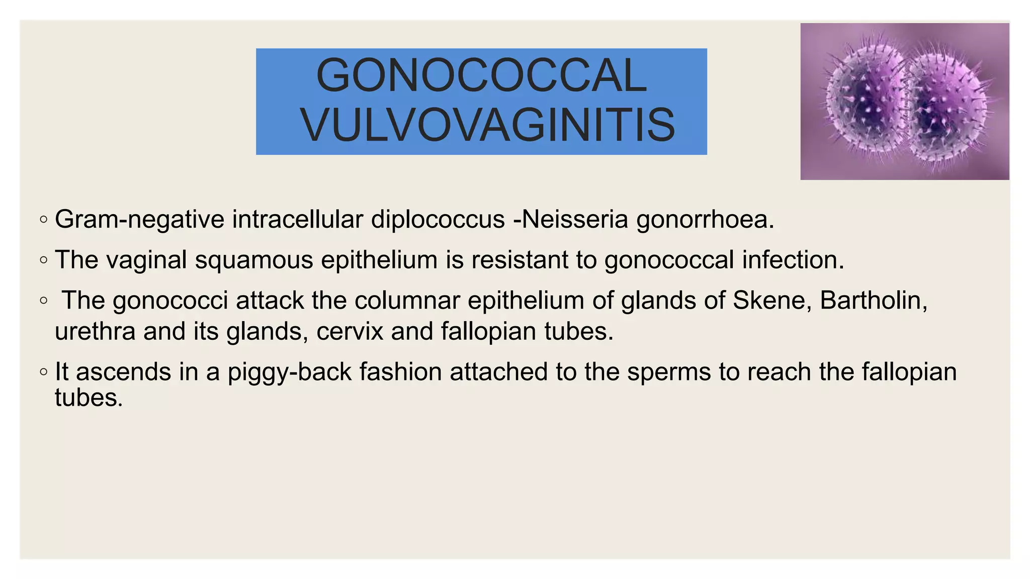 most common causes of infectious vaginitis.pptx