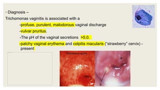 most common causes of infectious vaginitis.pptx