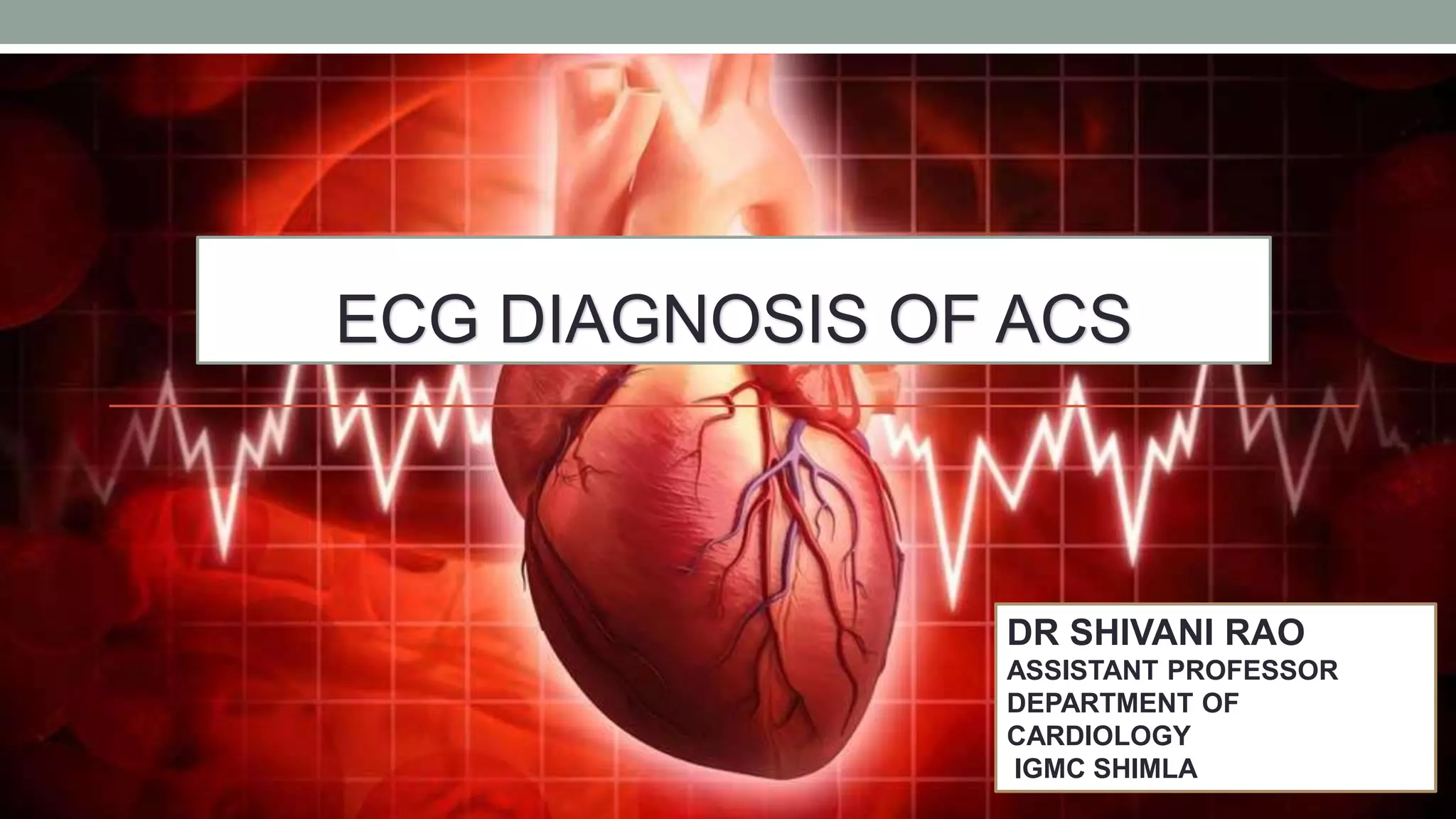 ECG DIAGNOSIS OF ACUTE CORONARY SYNDROME.pptx