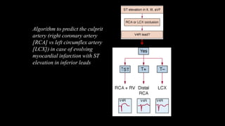 ECG DIAGNOSIS OF ACUTE CORONARY SYNDROME.pptx