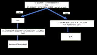 ECG DIAGNOSIS OF ACUTE CORONARY SYNDROME.pptx