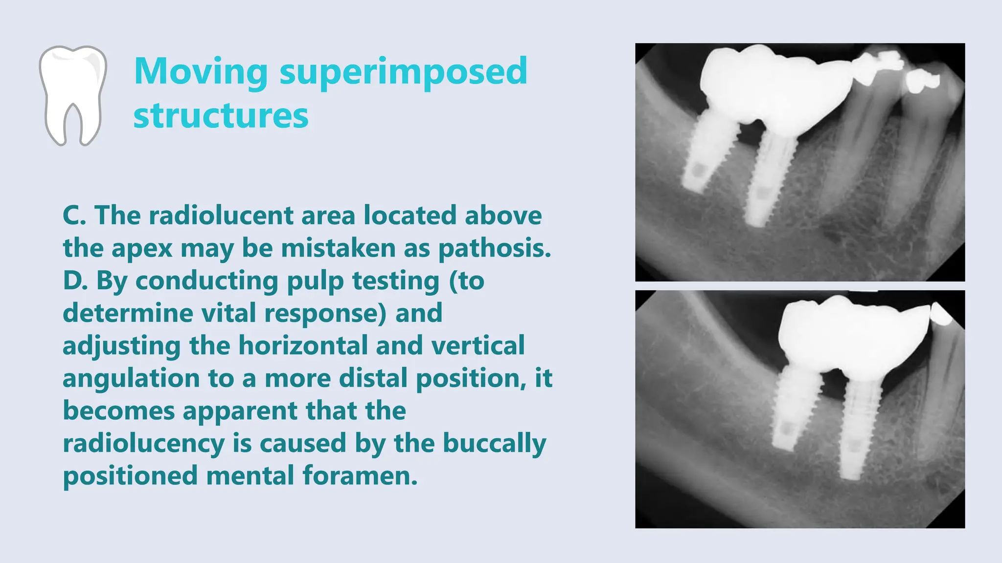 X-rays uses and benefits in endodontic treatment | PPTX