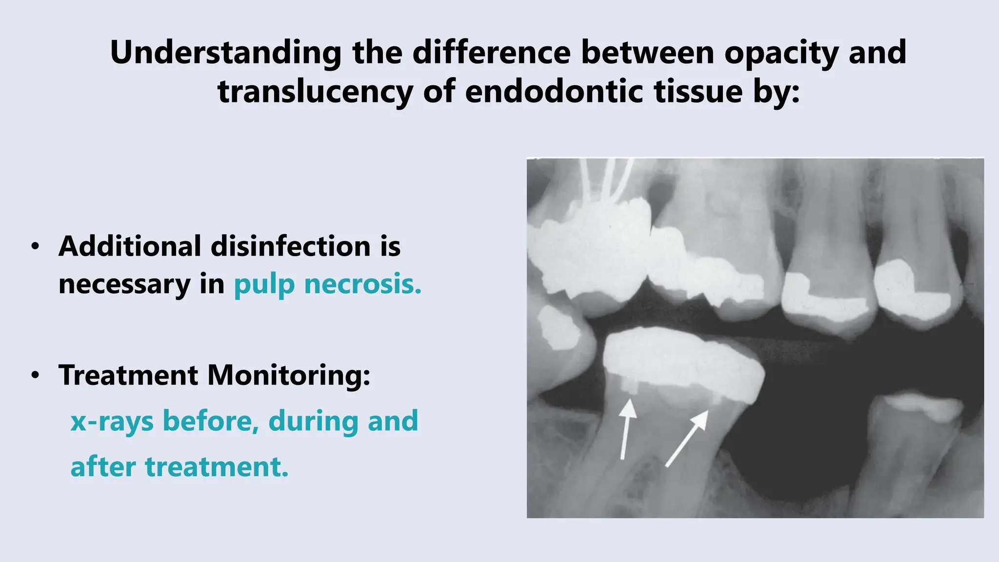 X-rays uses and benefits in endodontic treatment | PPTX