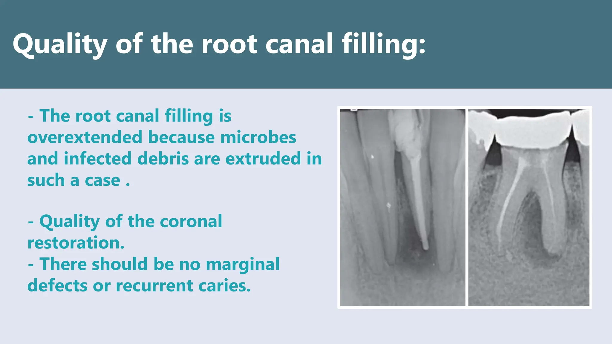 X-rays uses and benefits in endodontic treatment | PPTX