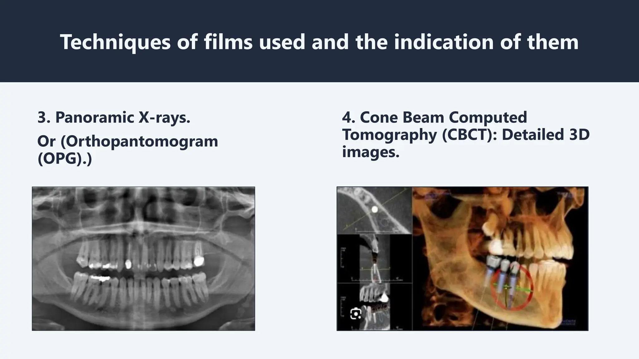 X-rays uses and benefits in endodontic treatment | PPTX
