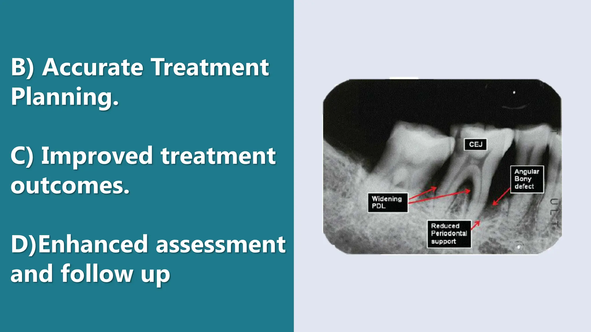 X-rays uses and benefits in endodontic treatment | PPTX
