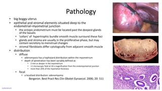 Adenomyosis and Infertility | PPTX