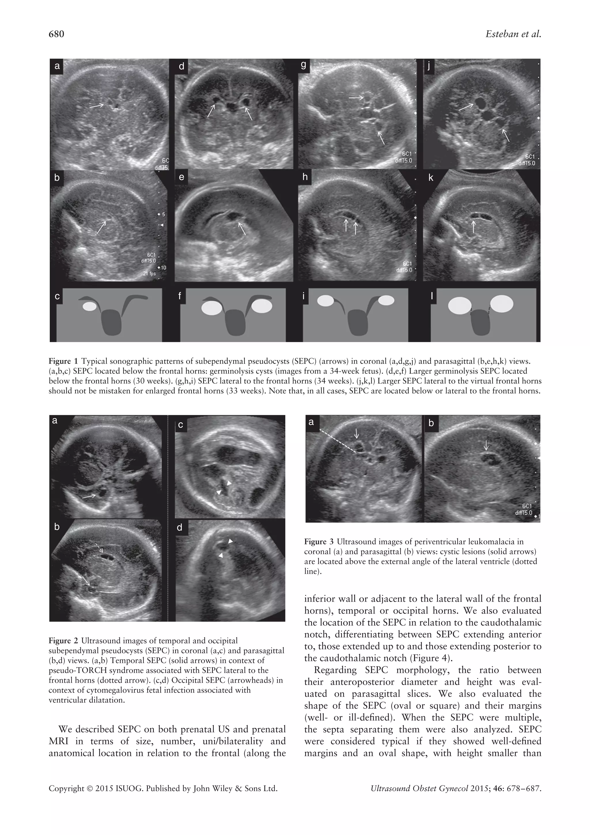 Final all-reading-material-neurosonogram isuog 2019 | PDF
