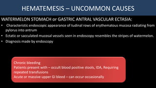 Approach to Gastrointestinal bleeding | PPT