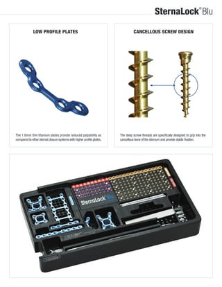 Final bluparts | PDF