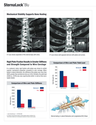 Final bluparts | PDF
