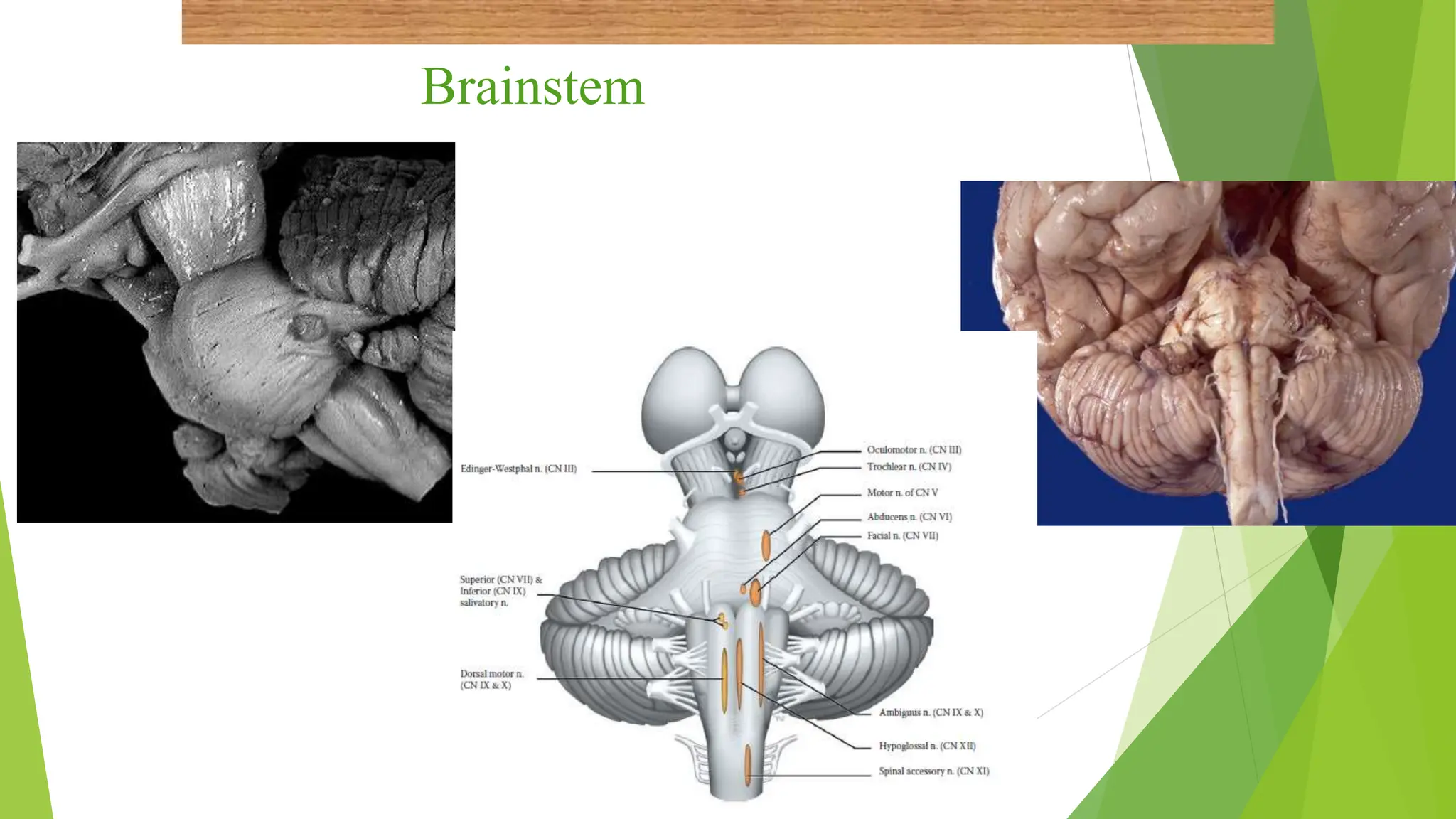 Final-Brainstem Syndromes and multiple Cranial nerve palsies.pptx