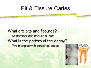 Dental Caries | PDF | Oral care | Personal Care