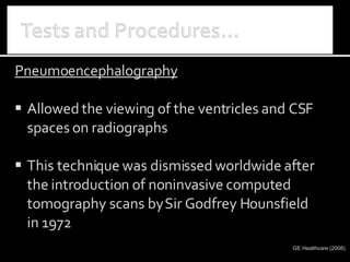 CT - Dandy Walker Syndrome | PPT
