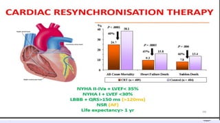 Heart Failure(HFrEF) management- an Overview | PPTX