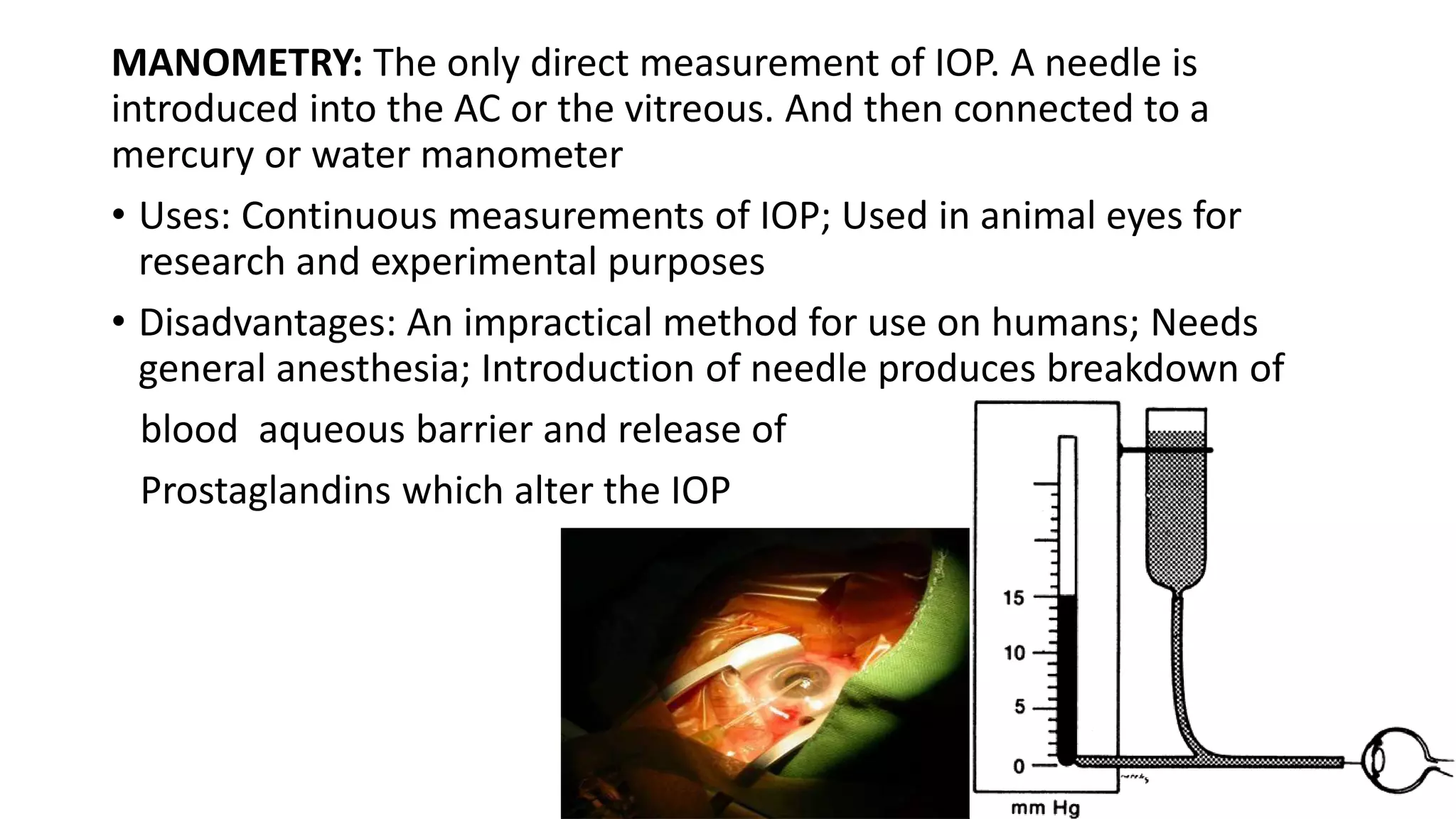 Means of IOP measurement | PPTX