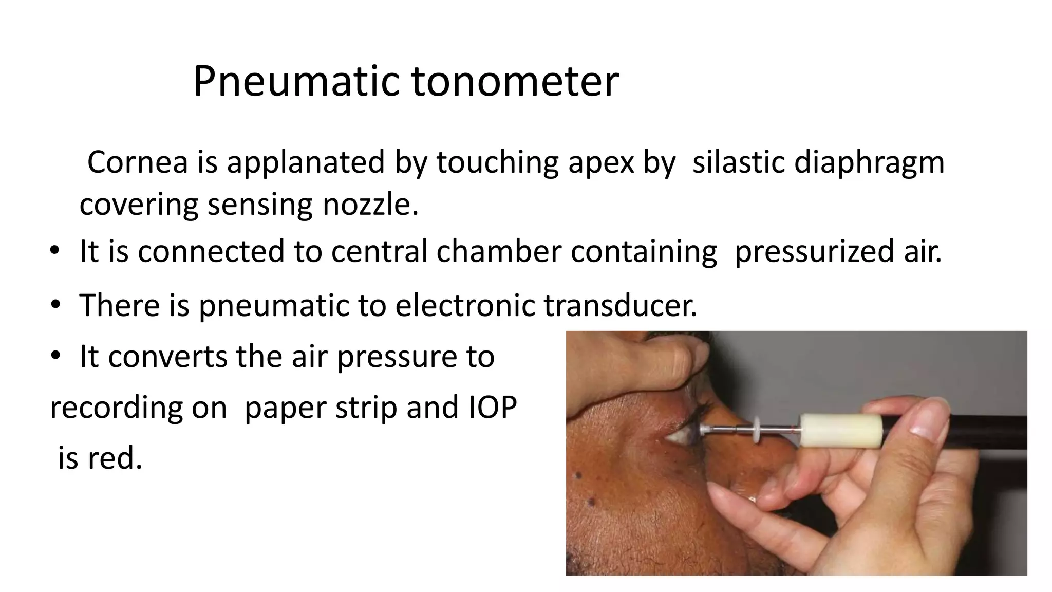 Means of IOP measurement | PPTX | Thyroid Disorders | Endocrine and ...