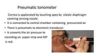 Means of IOP measurement | PPTX