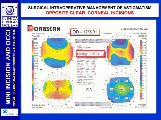 SURGICAL INTRAOPERATIVE MANAGEMENT OF ASTIGMATISM | PPT