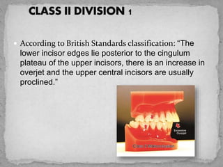 class 2 malocclusion | PPTX