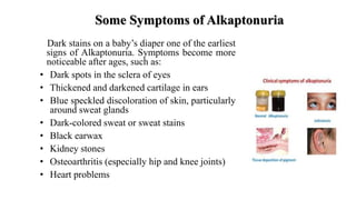 Maple Syrup Urine Disease, Phenylketonuria & Alkaptonuria | PPTX