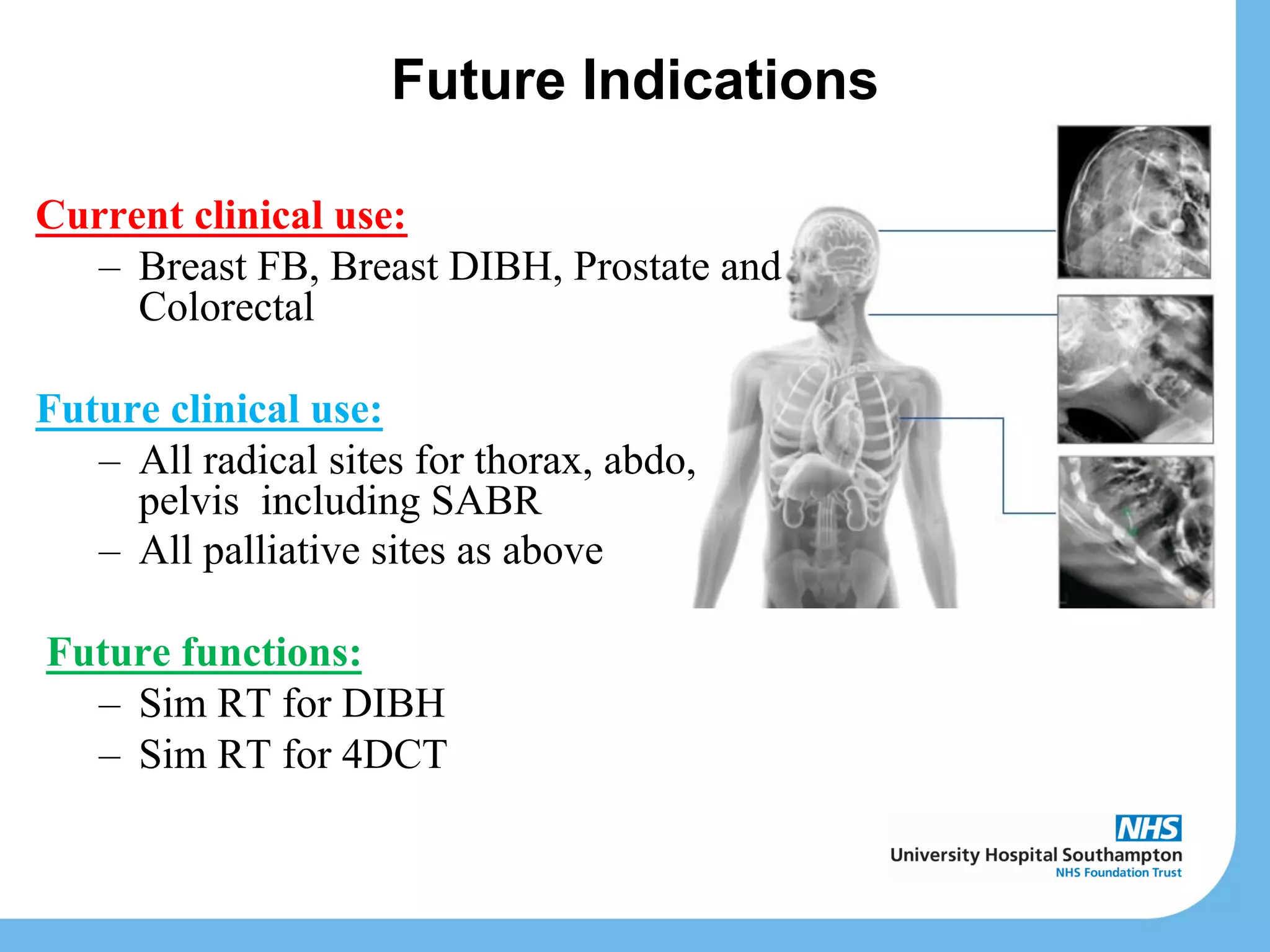 Measuring and Improving Radiotherapy Delivery Efficiency with SGRT ...