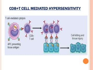 Final type-iv hypersensityvity | PPTX