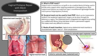 Uro-Gynaecology From Cambridge to UAE? | PDF