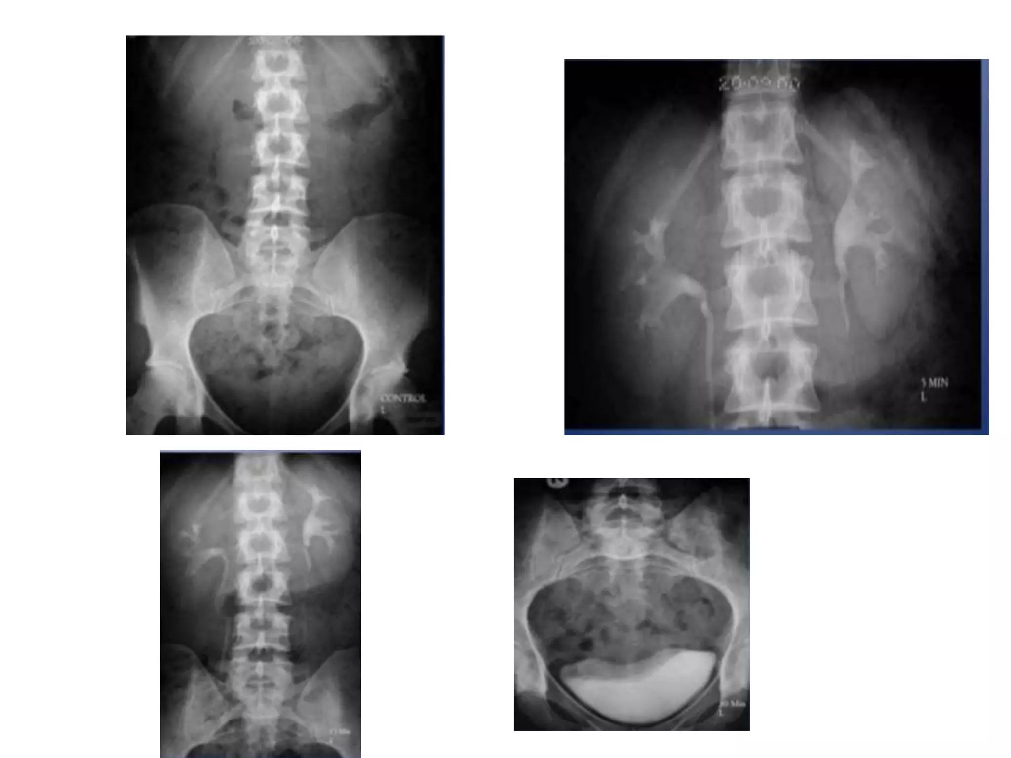 uses and indication of radiology in surgery | PPTX