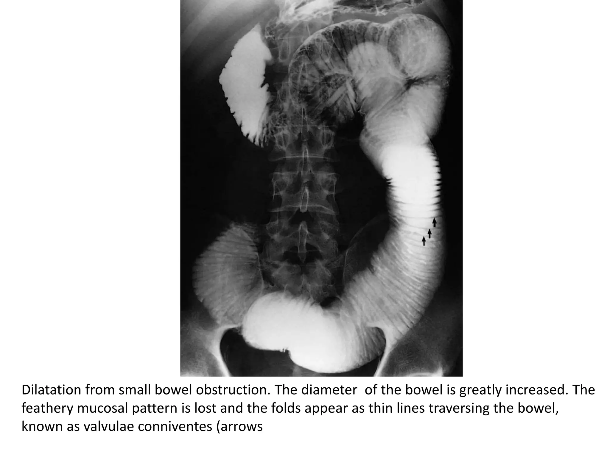 uses and indication of radiology in surgery | PPTX