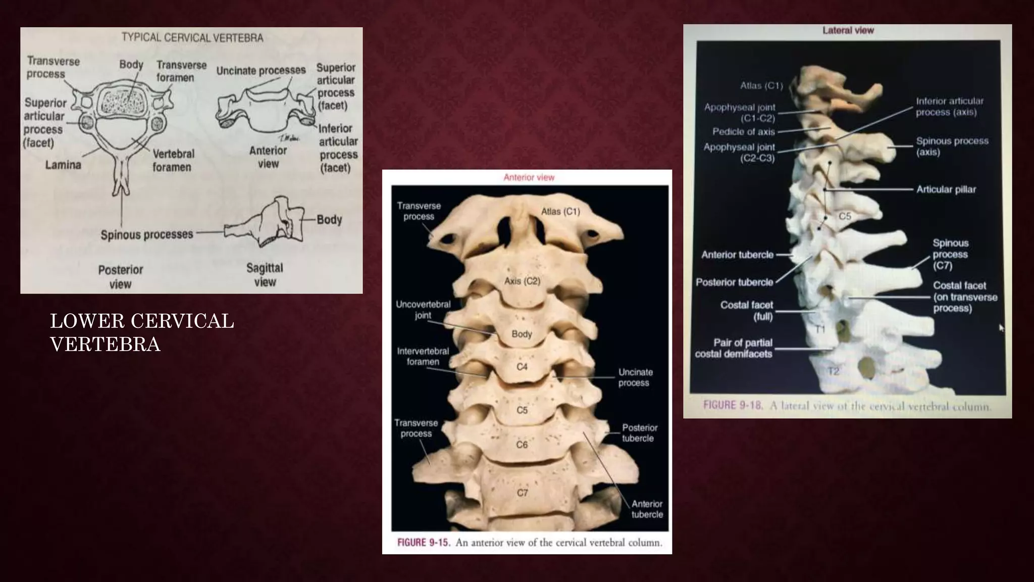 Applied Biomechanics of Cervical Spine | PPTX