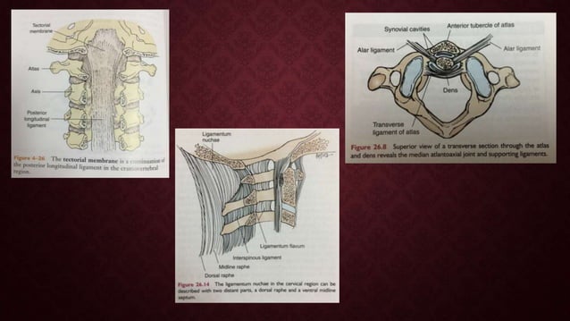 Applied Biomechanics of Cervical Spine | PPTX