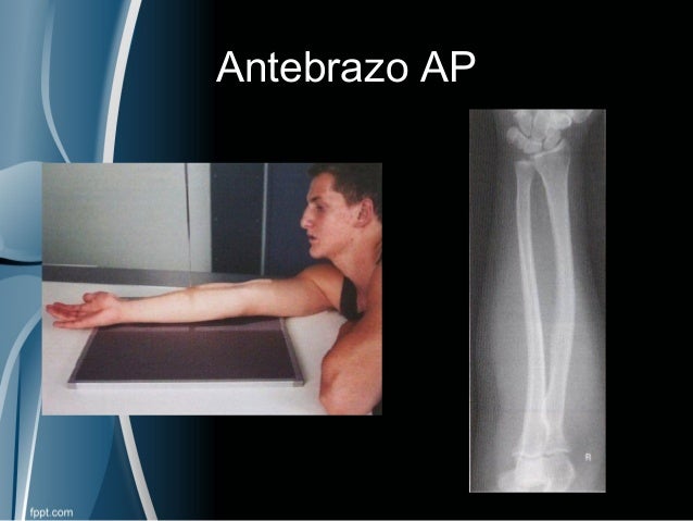 PROYECCIÓNES RADIOLÓGICAS EN TRAUMATOLOGÍA