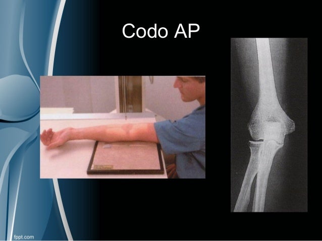 PROYECCIÓNES RADIOLÓGICAS EN TRAUMATOLOGÍA