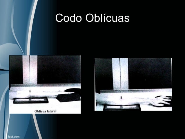 PROYECCIÓNES RADIOLÓGICAS EN TRAUMATOLOGÍA