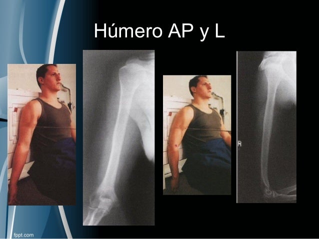 PROYECCIÓNES RADIOLÓGICAS EN TRAUMATOLOGÍA