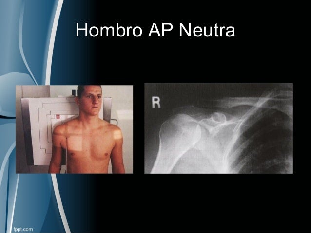 PROYECCIÓNES RADIOLÓGICAS EN TRAUMATOLOGÍA