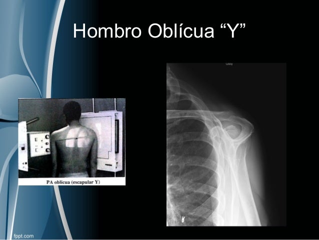 PROYECCIÓNES RADIOLÓGICAS EN TRAUMATOLOGÍA