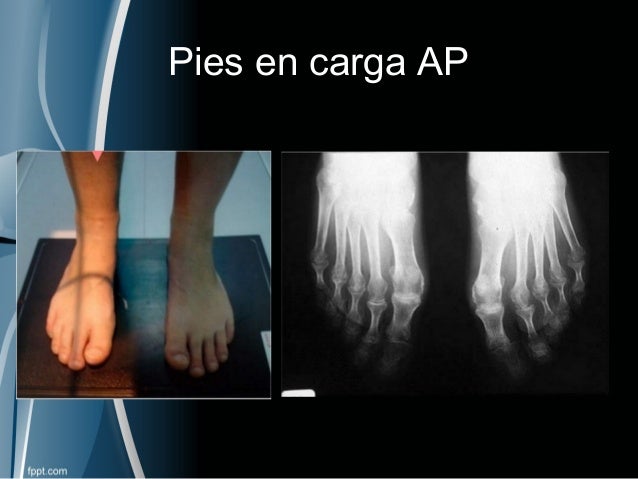 PROYECCIÓNES RADIOLÓGICAS EN TRAUMATOLOGÍA