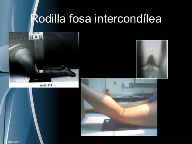 PROYECCIÓNES RADIOLÓGICAS EN TRAUMATOLOGÍA