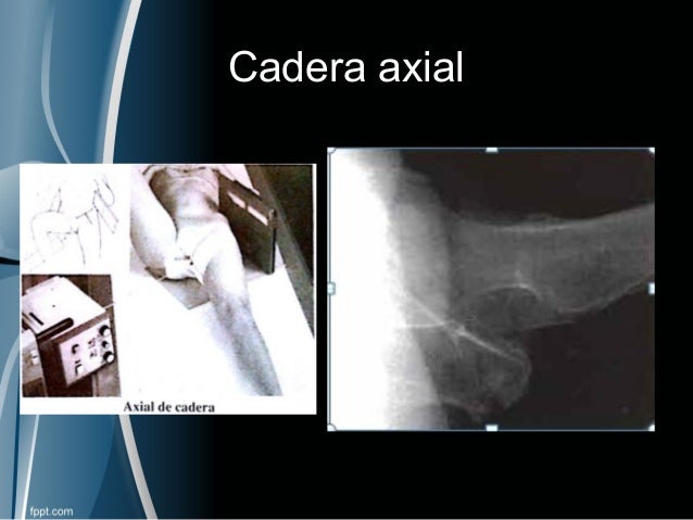 PROYECCIÓNES RADIOLÓGICAS EN TRAUMATOLOGÍA