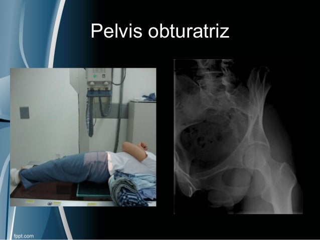 PROYECCIÓNES RADIOLÓGICAS EN TRAUMATOLOGÍA