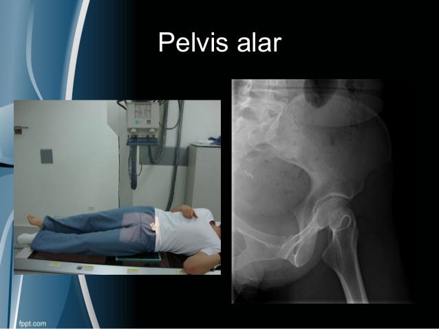 PROYECCIÓNES RADIOLÓGICAS EN TRAUMATOLOGÍA