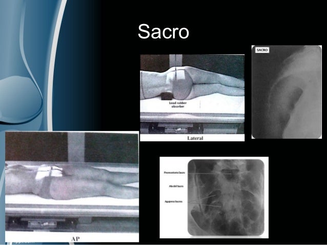 PROYECCIÓNES RADIOLÓGICAS EN TRAUMATOLOGÍA