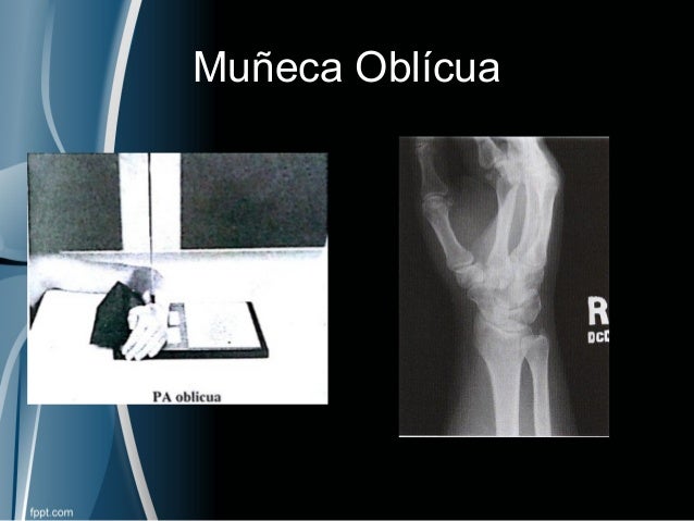 PROYECCIÓNES RADIOLÓGICAS EN TRAUMATOLOGÍA