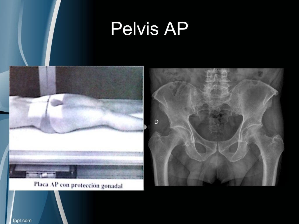 PROYECCIÓNES RADIOLÓGICAS EN TRAUMATOLOGÍA