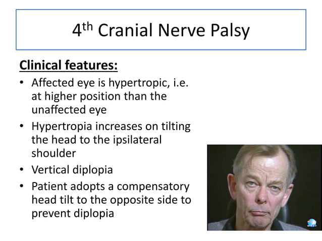 Common Neuro Ophthalmological Disorder | PPTX | Brain and Nervous ...