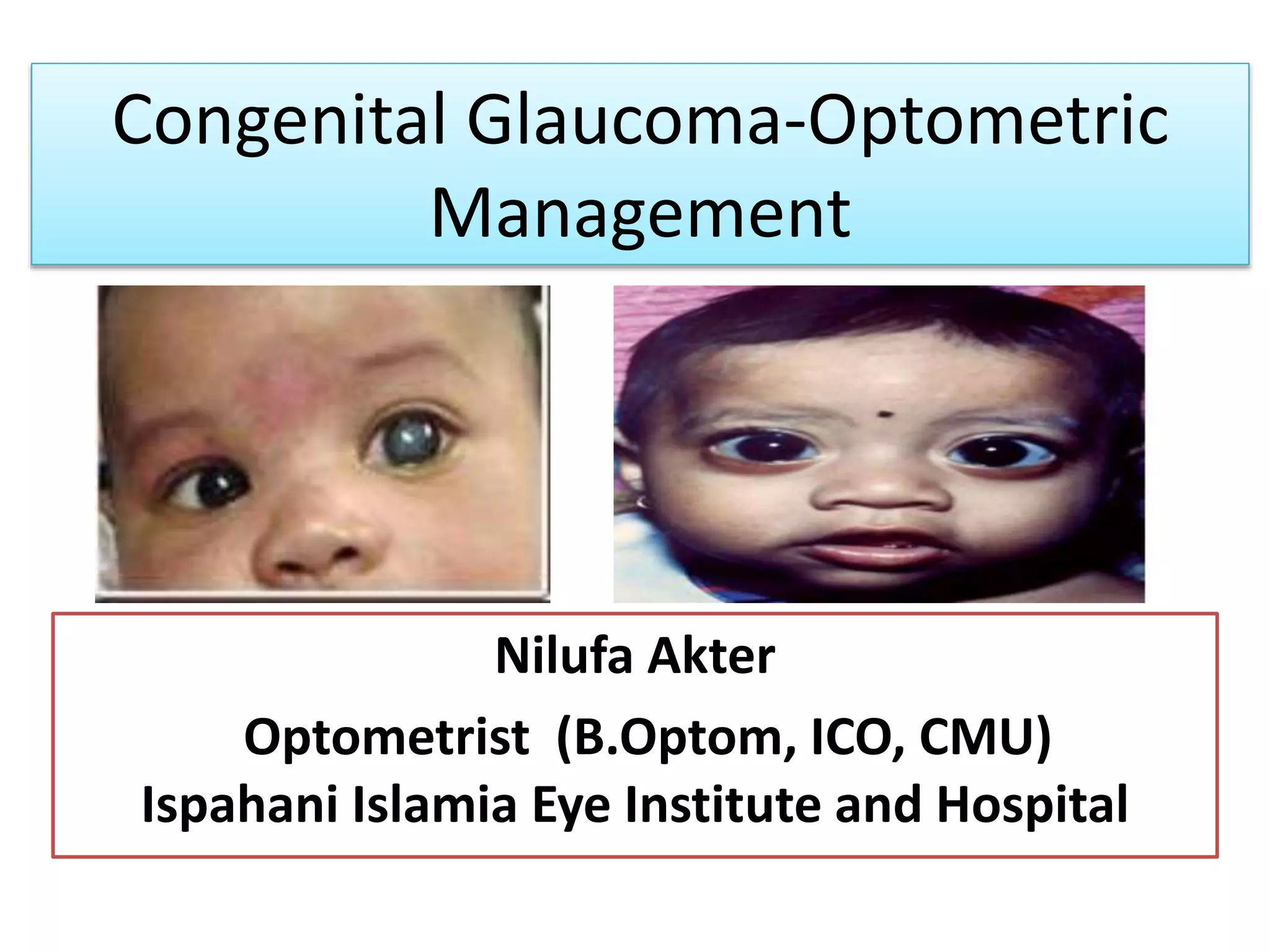 Congenital Glaucoma-Optometric managment.ppt